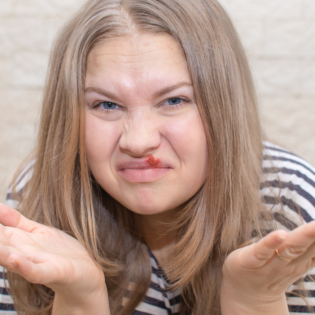 Home Remedy for Cold Sore: Soothing Relief with "Cold Be Gone Tea ...