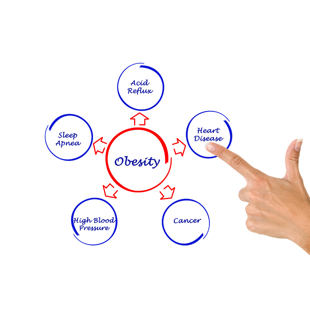 Combating Global Obesity: A Comprehensive Analysis and Solutions for a ...